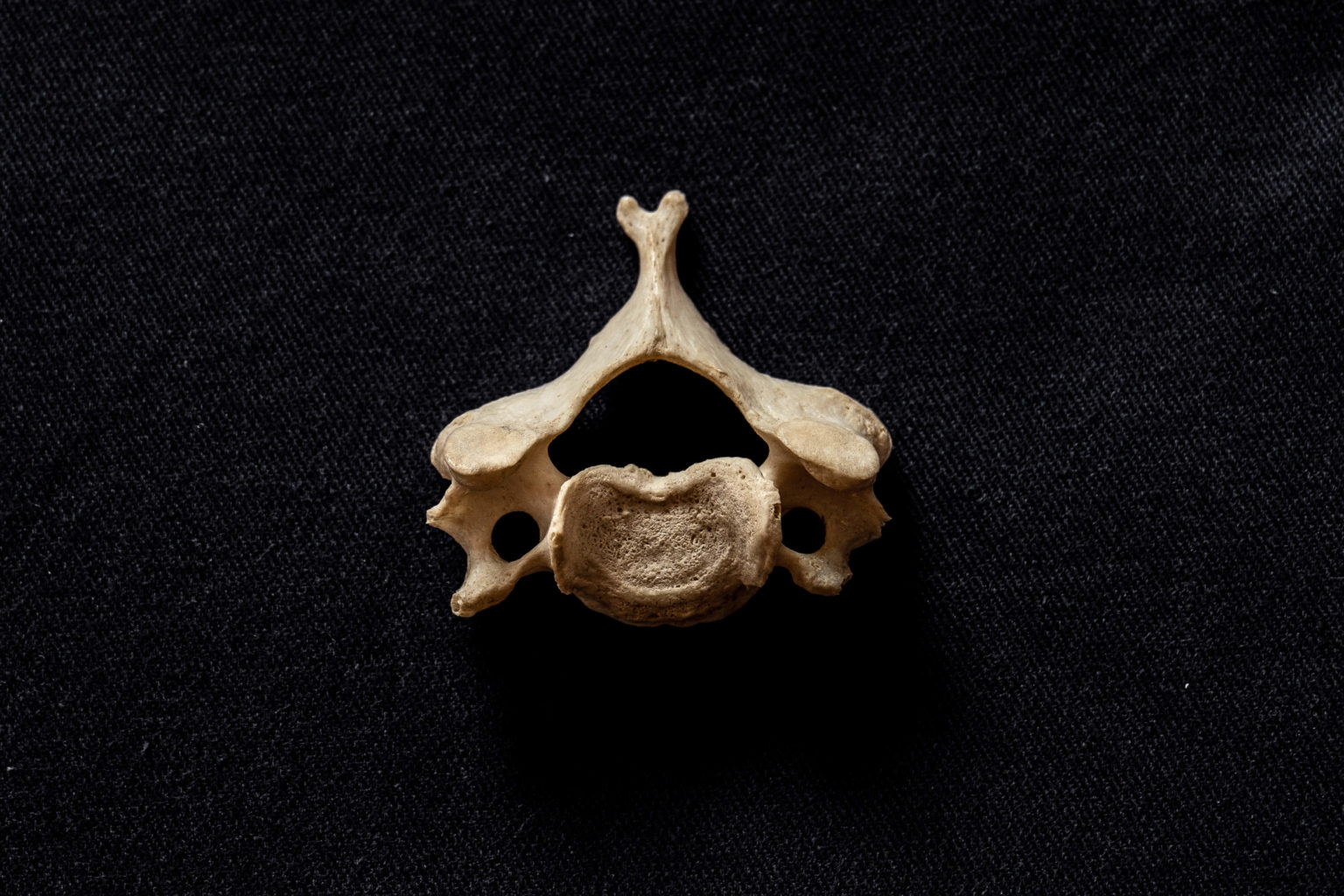 the-musculoskeletal-system-a-glossary-biscup-spine